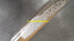 Germ Tube Test: Introduction, Principle, Procedure, Result