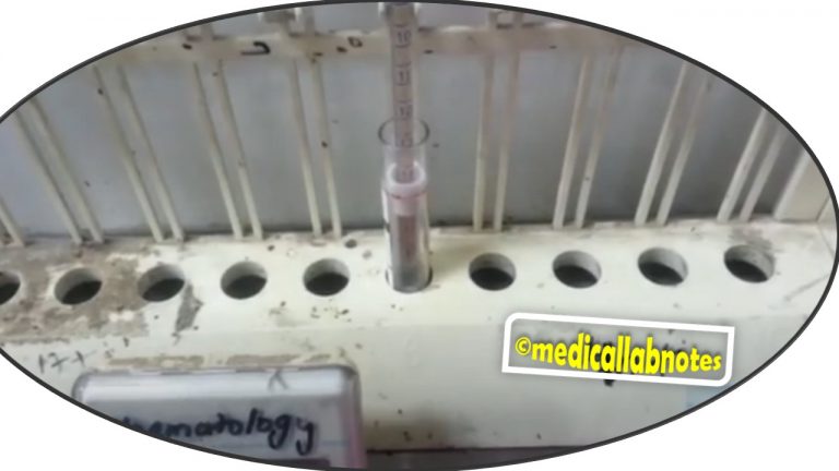 Common Instruments and Reagents Used in Hematology Laborat