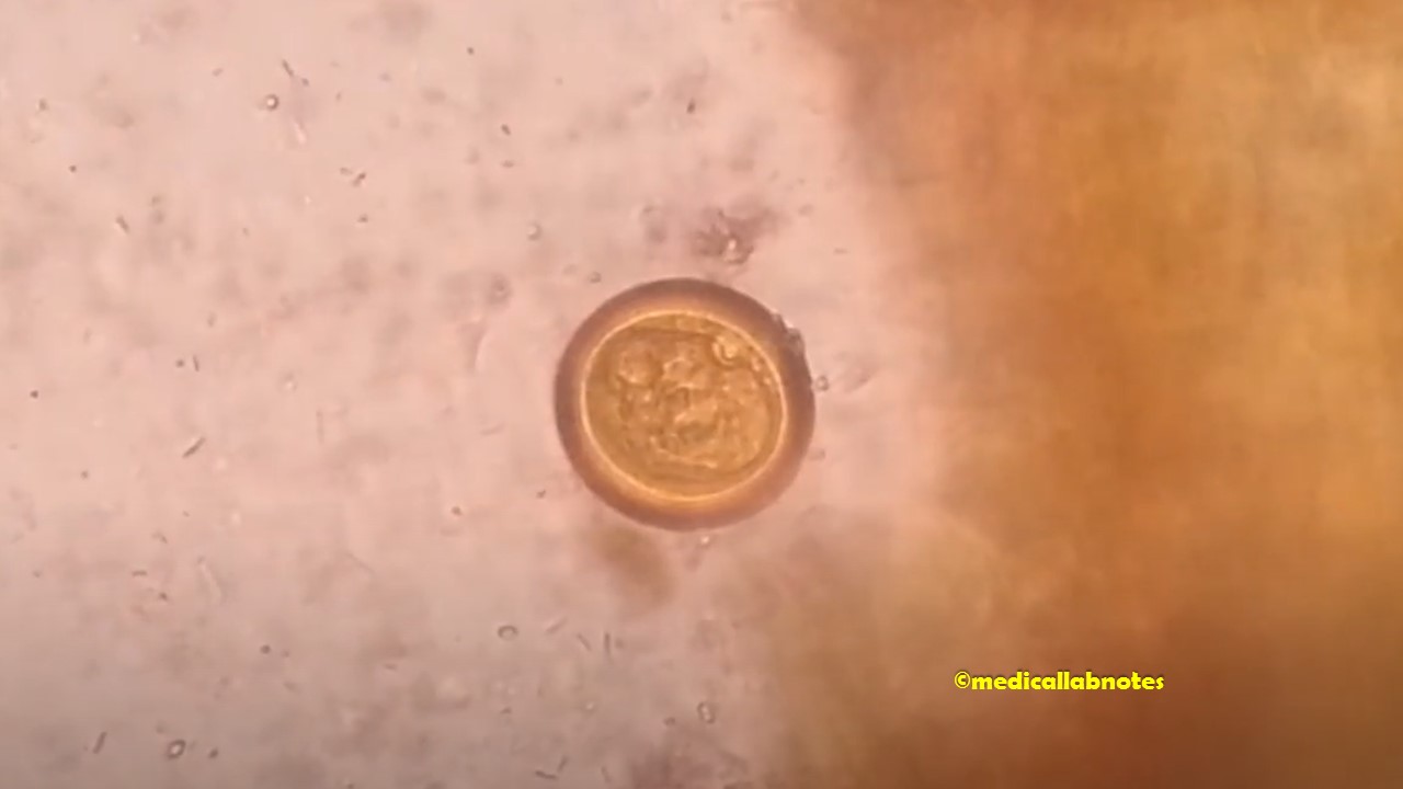 Atlas of Parasites: Introduction, List of Contents, and Description