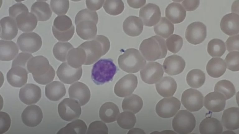 Atlas of Blood Cells in Hematology: Introduction, List of Content