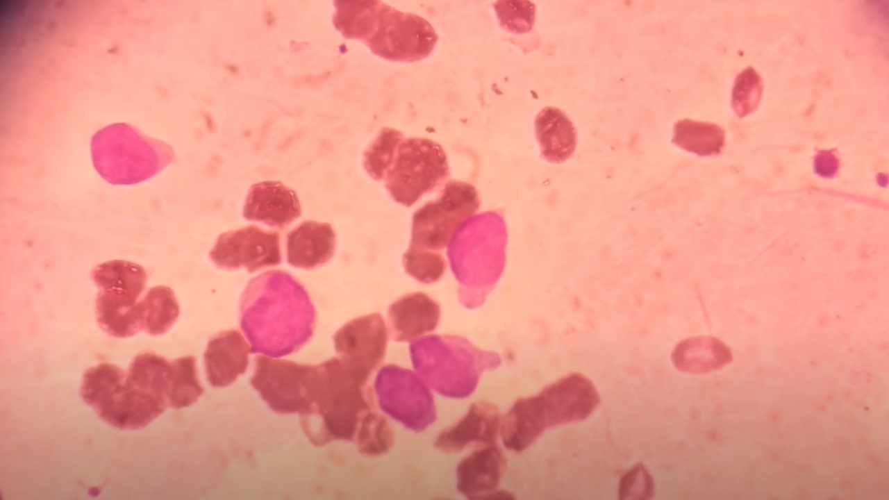 Atlas of Blood Cells in Hematology: Introduction, List of Content