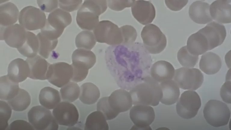 Atlas of Blood Cells in Hematology: Introduction, List of Content