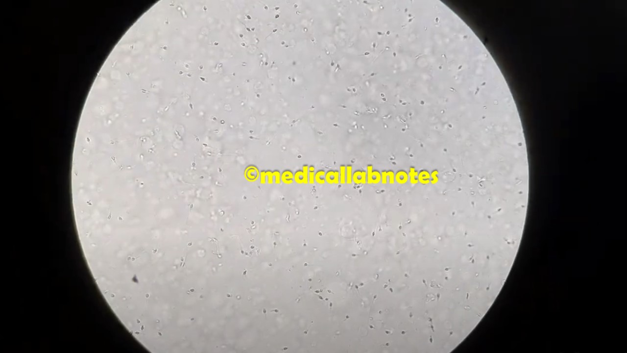 Semen Analysis: Introduction, List of Tests, Unit, and Normal Range