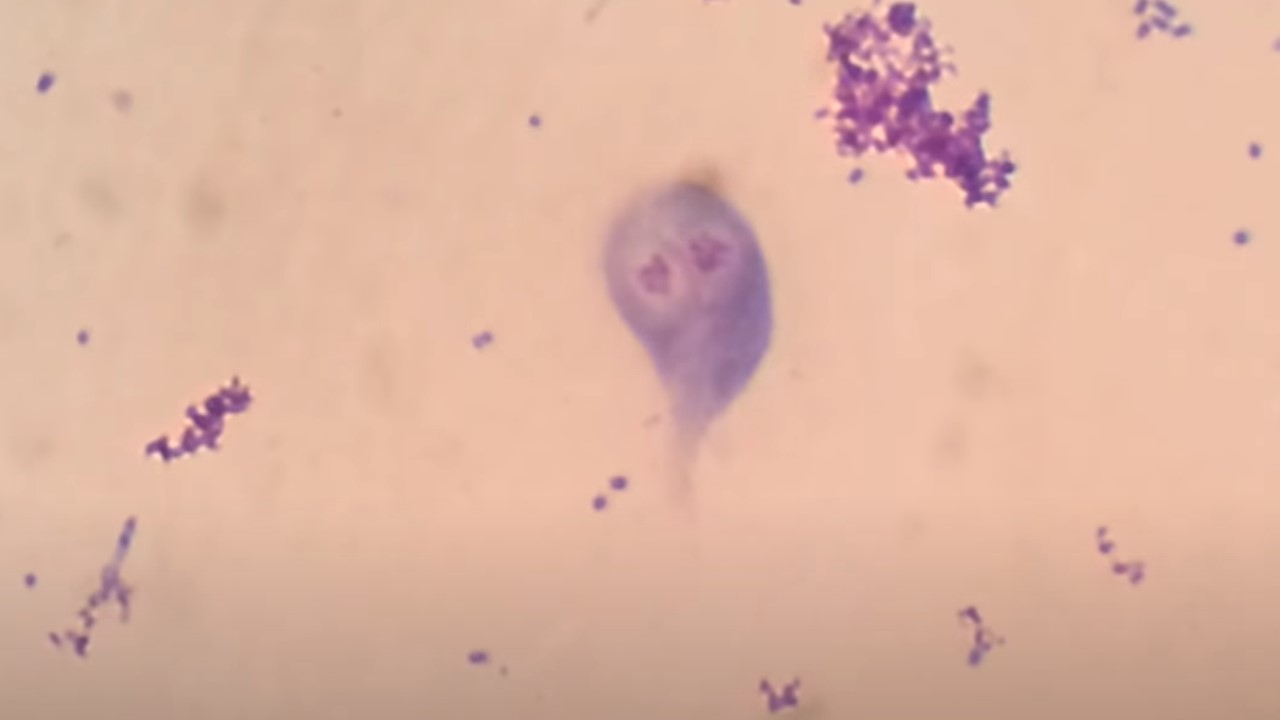 Atlas of Parasites: Introduction, List of Contents, and Description