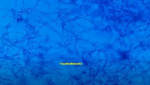 Methylene Blue Stain: Introduction, Principle, Composition, Prepar