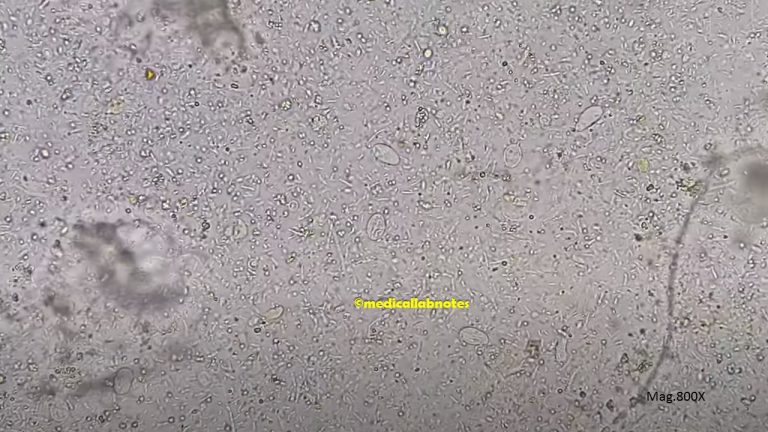 Saline Wet Mount Microscopy Introduction Principle Test Requi Saline Wet Mount Microscopy Introduction Principle Test Requi