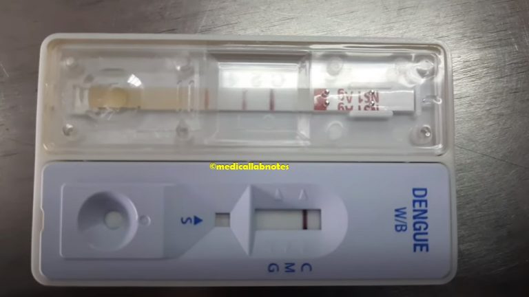 Immunochromatographic Test (ICT): Introduction, Principle, Test