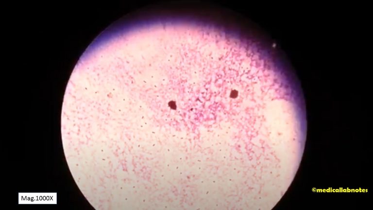 Gram-Positive Bacteria Identification: Introduction, List of Common