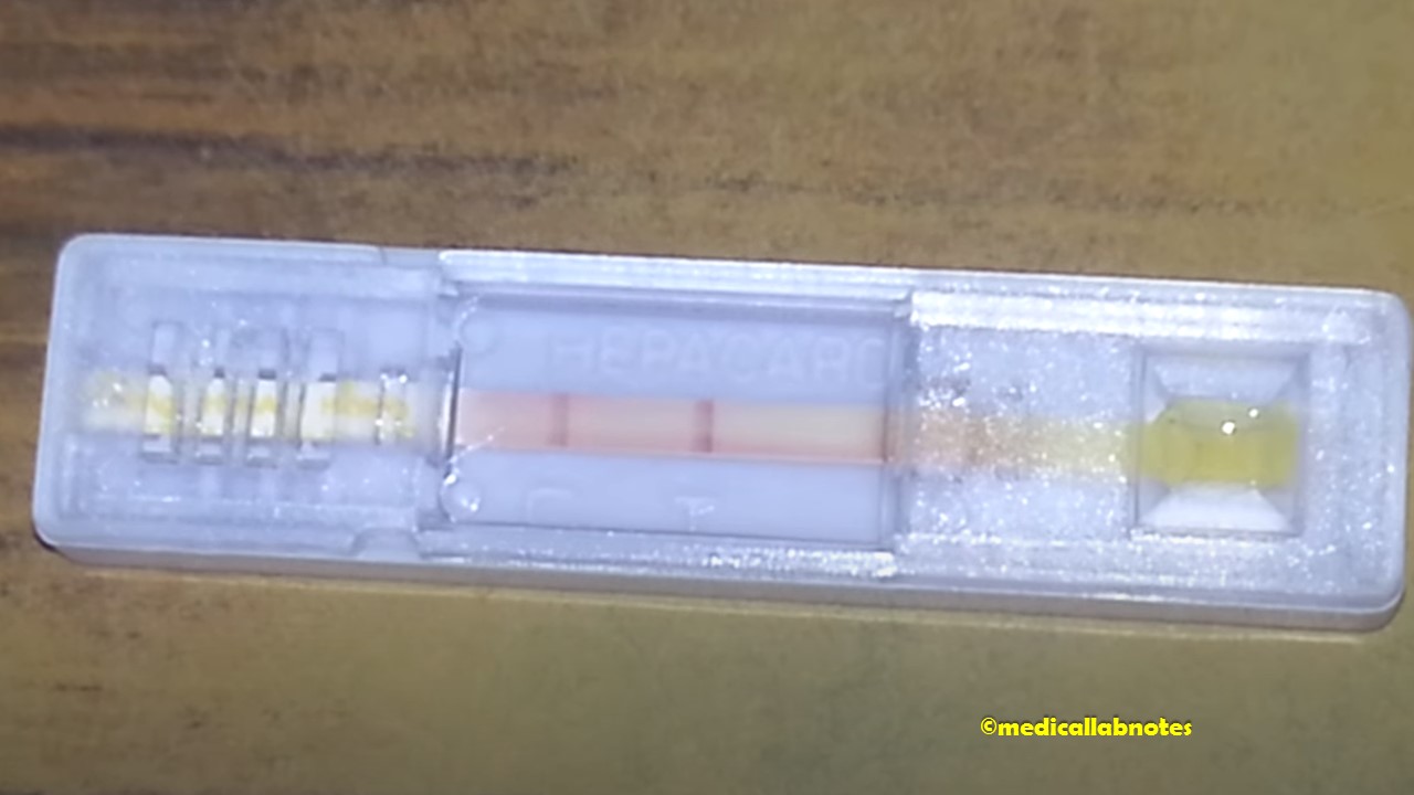 Immunochromatographic Test (ICT): Introduction, Principle, Test