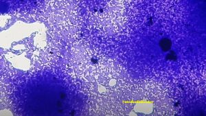 Methylene Blue Stain: Introduction, Principle, Composition, Prepar