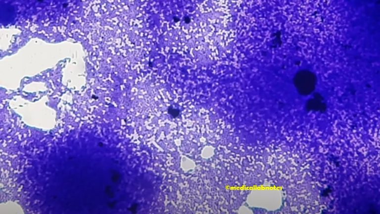 Methylene Blue Stain: Introduction, Principle, Composition, Prepar