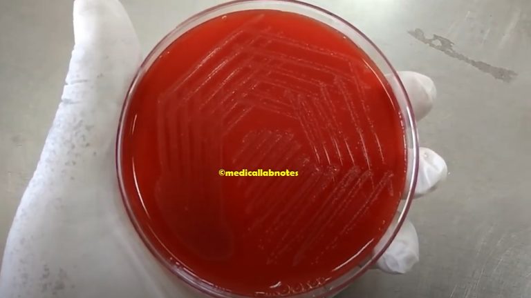 Gram Positive Bacteria Identification Introduction List Of Common