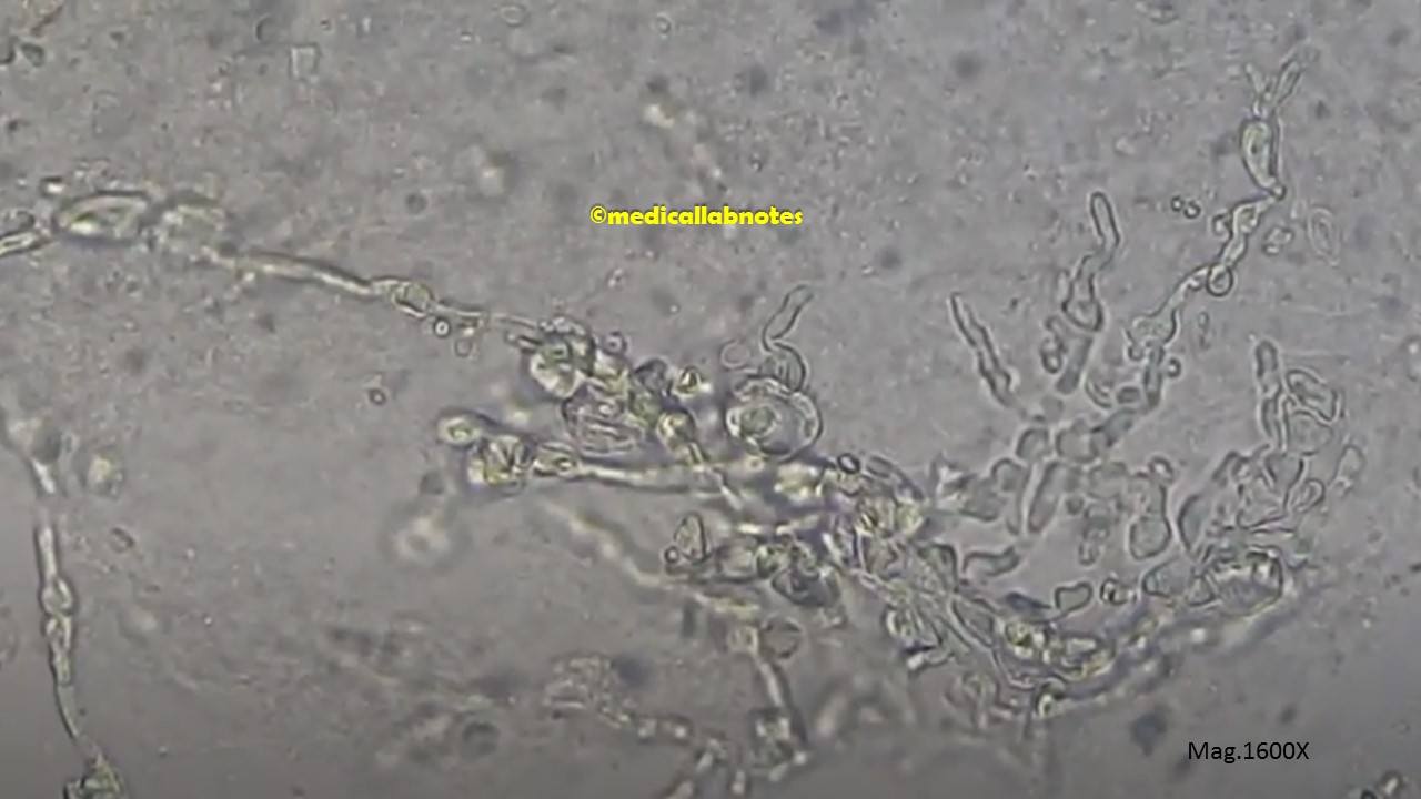 KOH Wet Mount Preparation: Introduction, Principle, Test Require