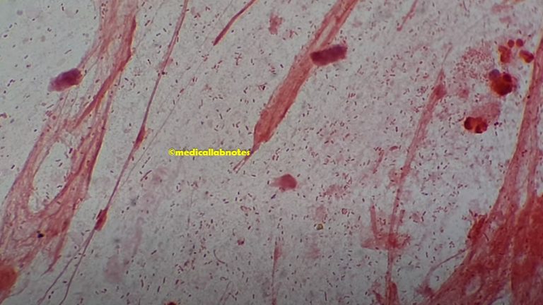 Gram Stain: Introduction, Principle, Test Requirements, Procedure