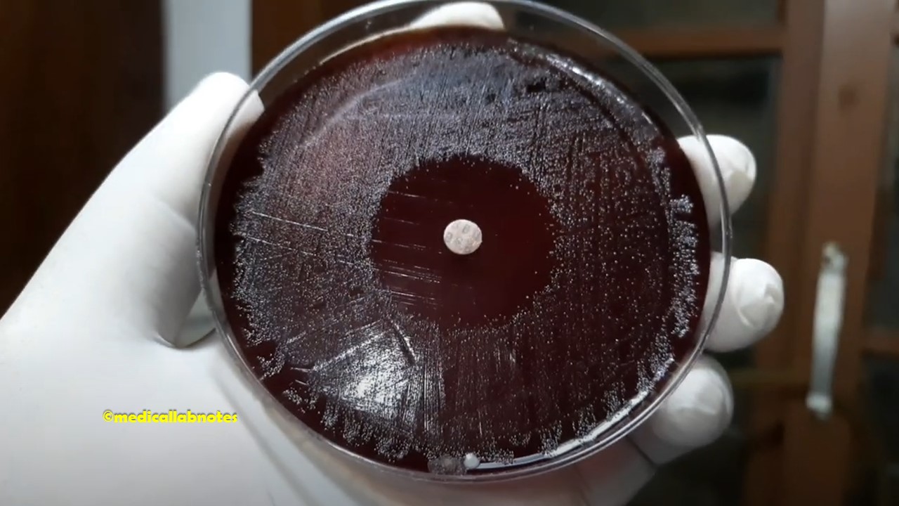Gram-Positive Bacteria Identification: Introduction, List of Common