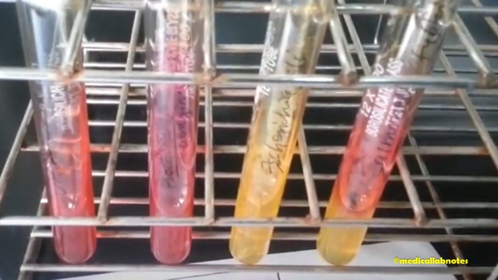 Pseudomonas In TSI Test Archives Medical Notes Pseudomonas In TSI Test Archives Medical Notes
