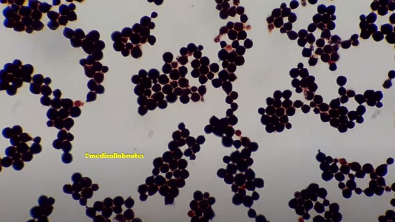 Gram Stain: Introduction, Principle, Test Requirements, Procedure