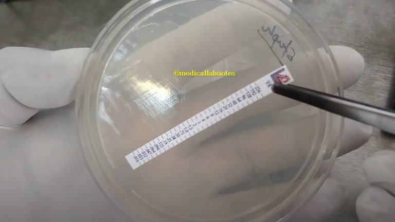 Mueller-Hinton agar (MHA): Introduction, Composition, Principle,