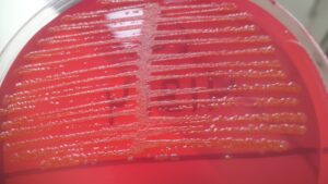 Citrobacter freundii: Introduction, Identification Features