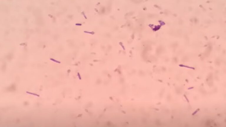 Gram Positive Bacilli or Rods: Introduction, List of Bacteria, Keyno