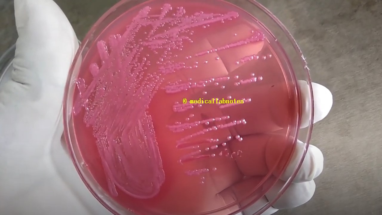 Lactose Fermenter (LF) and Non-Lactose Fermenter (NLF) Gram
