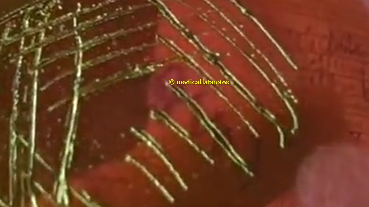 E. coli: Introduction, Identification Features, Keynotes