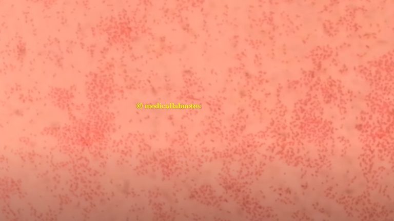Gram-Negative Bacilli and Coccobacilli Bacteria: Introduction, List