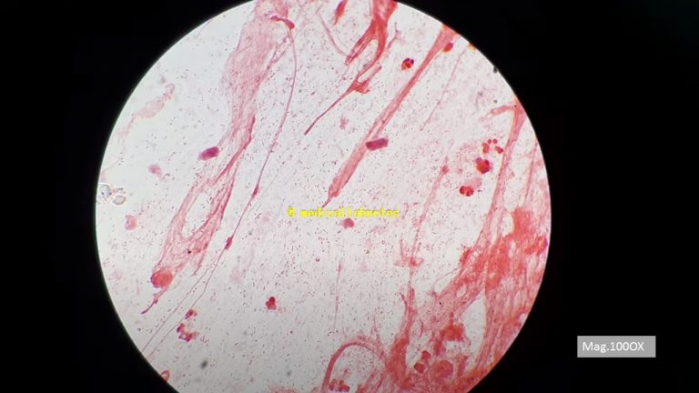 Use of X, V, and XV Growth Factors Disks for Haemophilus species