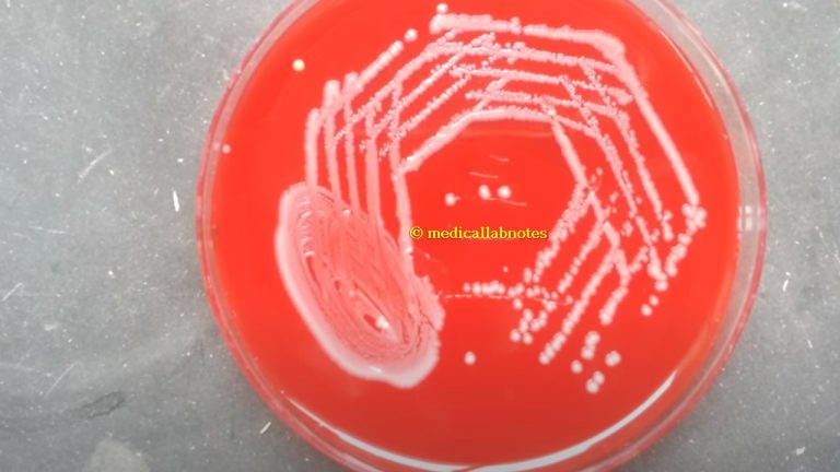 Gram-Negative Cocci (GNC) Bacteria: Introduction, List of Bacteria