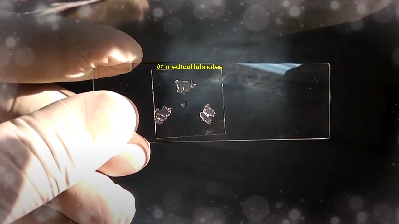 Vibrio cholerae: Introduction, Identification Features, Keynotes,