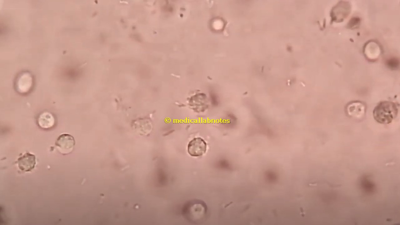 Klebsiella pneumoniae: Introduction, Identification Features,