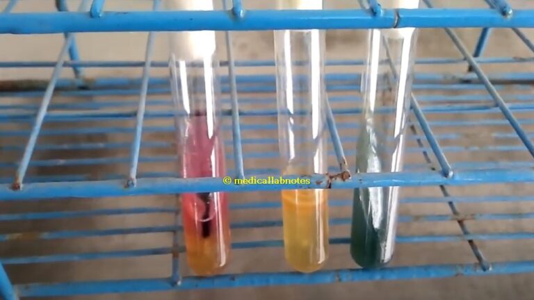 Biochemical Test of Gram-Negative Bacteria: Introduction, Common