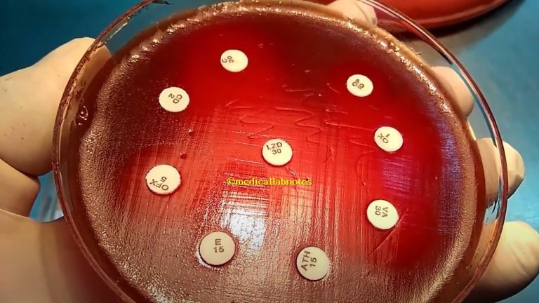 Mueller-Hinton agar (MHA): Introduction, Composition, Principle,