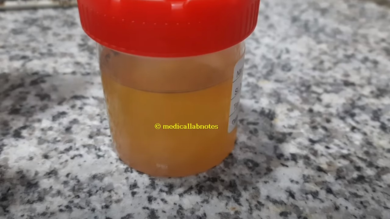 Klebsiella pneumoniae: Introduction, Identification Features,