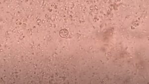 Cyclospora: Introduction, Classification, Morphology, Pathogenicity