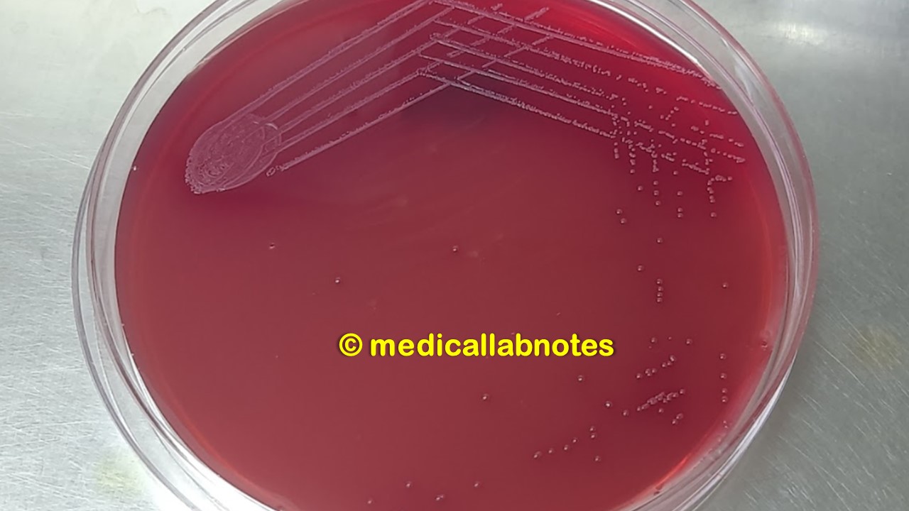 Enterococcus faecalis: Introduction, Keynotes, and Related Foot