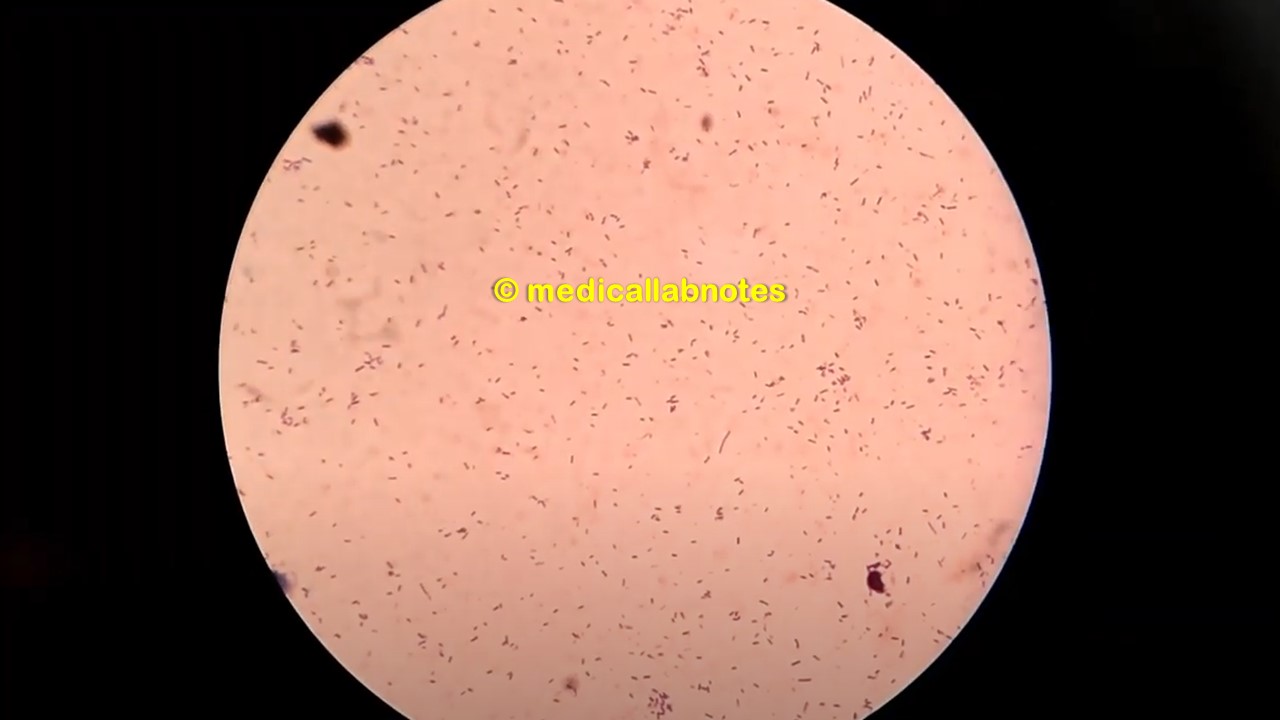 Gram-Positive and Gram-Negative Bacteria: Introduction, Differenc