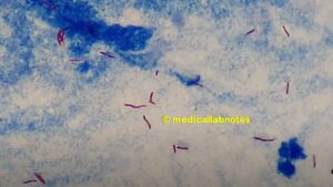 Gram-Positive and Gram-Negative Bacteria: Introduction, Differenc