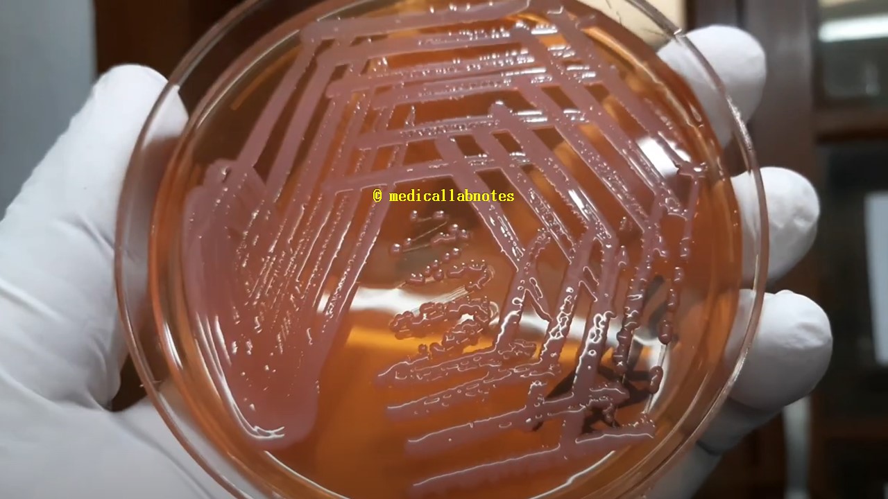 Macconkey Agar: Introduction, Principle, Composition, Preparation – CJCP