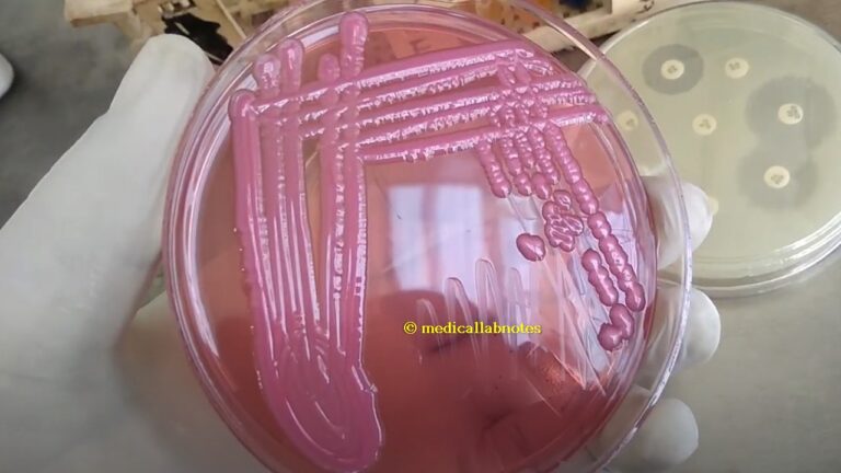 MacConkey Agar: Introduction, Principle, Composition, Preparation