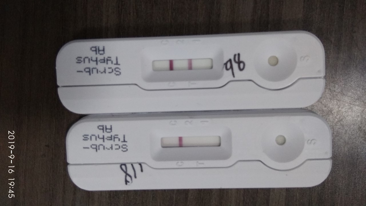 Serological Tests: Introduction, Some Common Serological Test