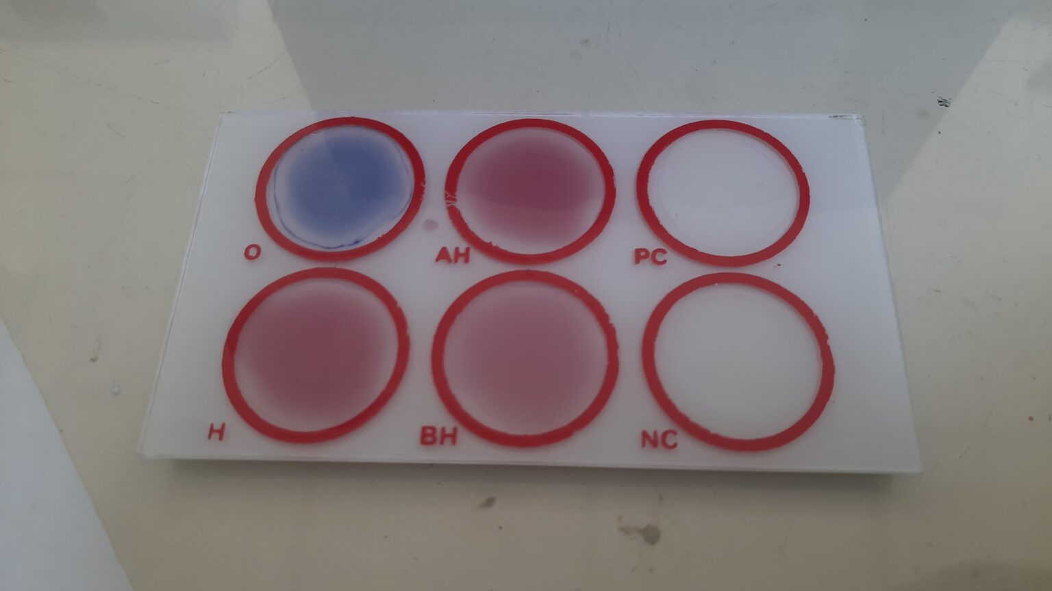 Serological Tests: Introduction, Some Common Serological Test