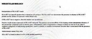 HLA-B27 Test: Introduction, Result-Interpretation, Clinical