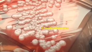 CLED Agar: Introduction, Composition, Principle, Preparation