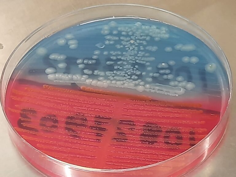 CLED Agar: Introduction, Composition, Principle, Preparation