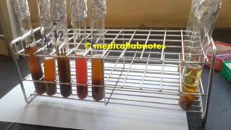 Robertson’s Cooked Meat (RCM) Medium: Introduction, Principle