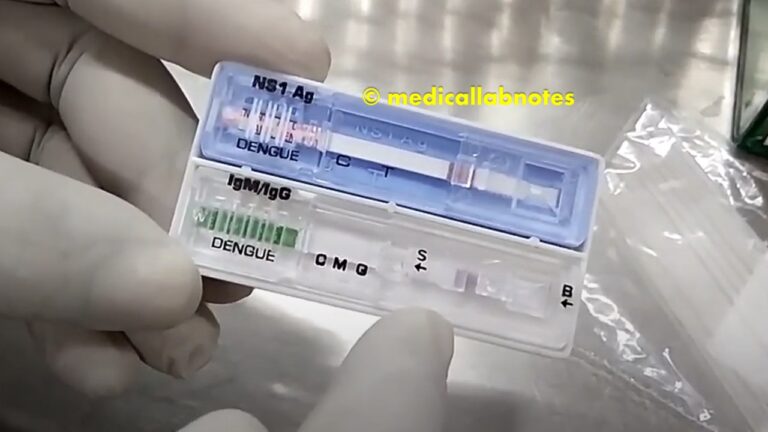 Dengue Rapid Test for IgG and IgM Detection: Introduction, Princi