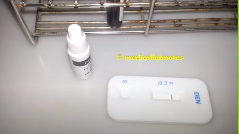 Dengue Rapid Test for IgG and IgM Detection: Introduction, Princi