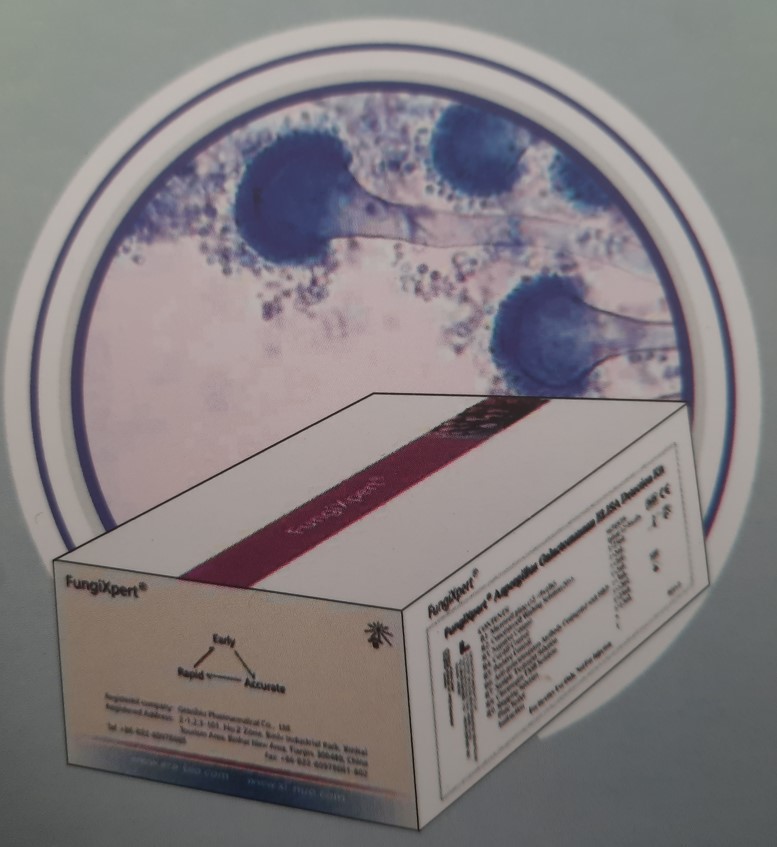 Aspergillus Galactomannan ELISA Detection Kit Introduction Principle 