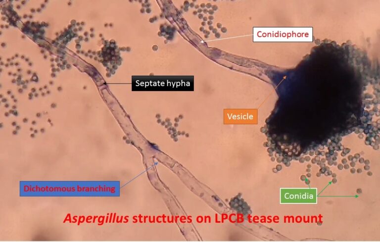 Aspergillus: Introduction, Classification, Colony Morphology, Patho